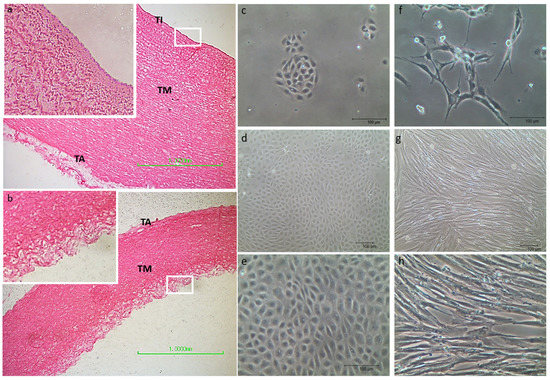 Isolation of Vascular Wall Mesenchymal Stem Cells from the Thoracic ...