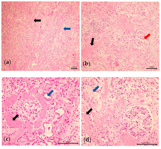 Oak Acorn Poisoning in Cattle during Autumn 2022: A Case Series and ...