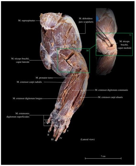 Functional Anatomy of the Thoracic Limb of the Komodo Dragon (Varanus ...