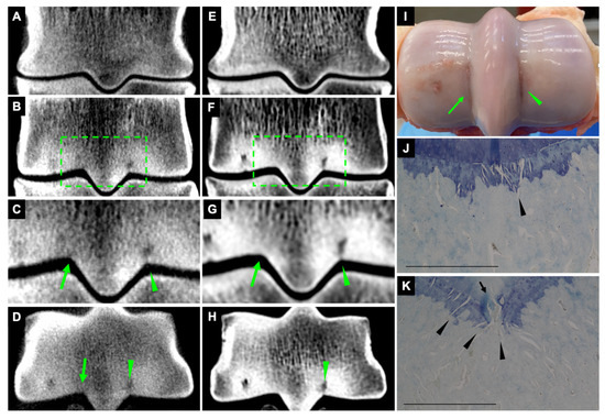 Three-Dimensional Imaging and Histopathological Features of Third ...