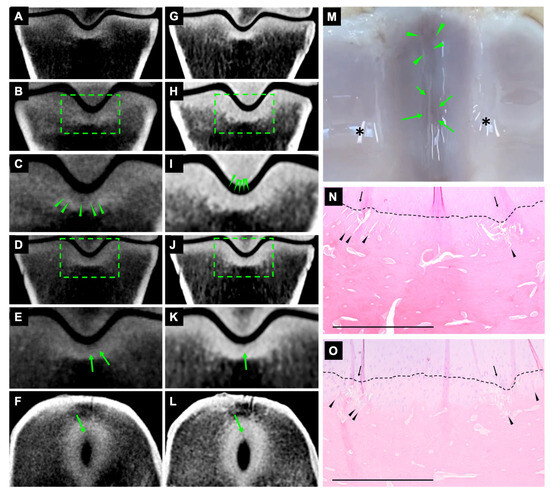 Three-Dimensional Imaging and Histopathological Features of Third ...