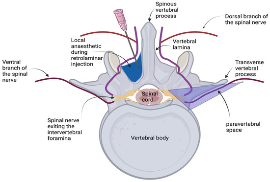 Animals | Free Full-Text | Thoracolumbar Retrolaminar Block: Anatomical ...