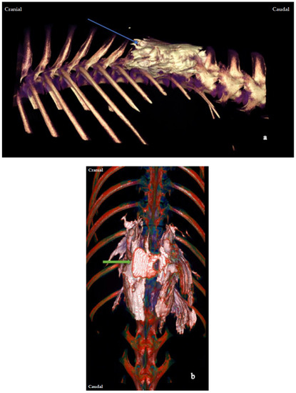 Thoracolumbar Retrolaminar Block: Anatomical and Radiological Study of ...