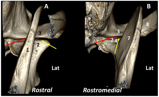 Three-Dimensional Volume Rendering in Computed Tomography for ...