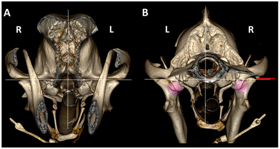 Three-Dimensional Volume Rendering in Computed Tomography for ...