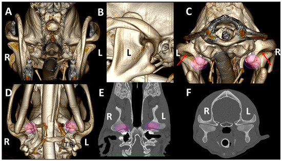 Three-Dimensional Volume Rendering in Computed Tomography for ...