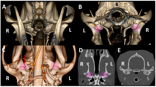 Three-Dimensional Volume Rendering in Computed Tomography for ...
