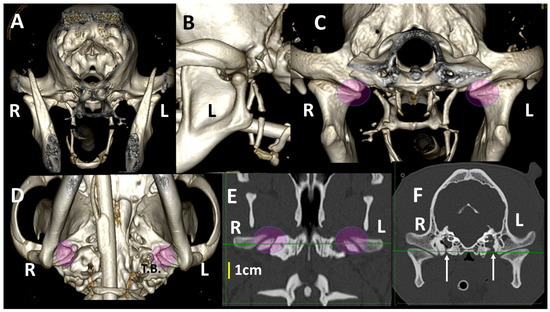 Three-Dimensional Volume Rendering in Computed Tomography for ...