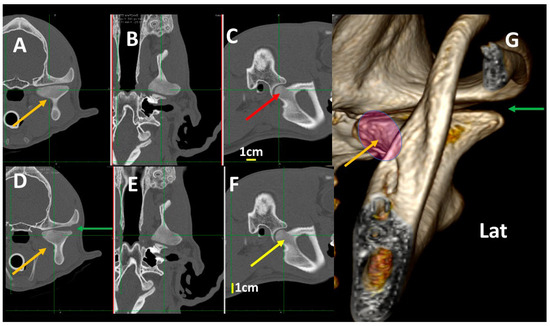 Three-Dimensional Volume Rendering in Computed Tomography for ...