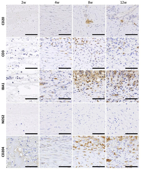 Structural Features of Connective Tissue Formed around Resin Implants ...