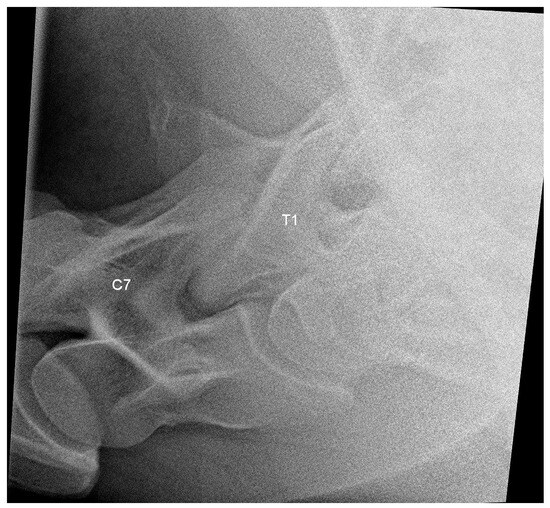 Radiological Methods for the Imaging of Congenital Malformations of C6 ...