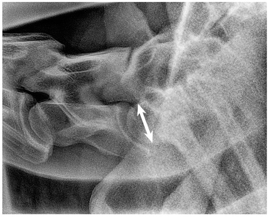 Radiological Methods for the Imaging of Congenital Malformations of C6 ...