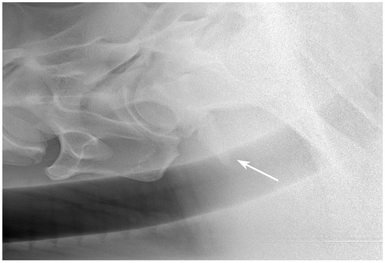 Radiological Methods for the Imaging of Congenital Malformations of C6 ...