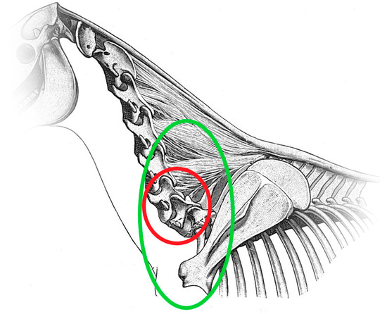 Radiological Methods for the Imaging of Congenital Malformations of C6 ...