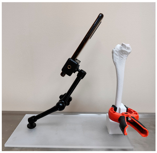 Comparison of the Visibility of Canine Menisci before and after Tibial ...