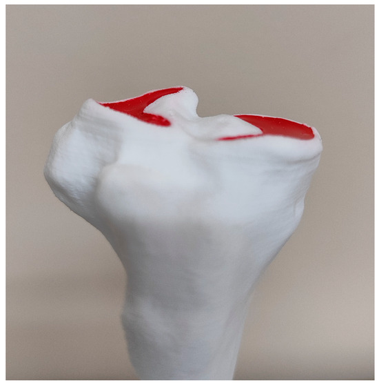 Comparison of the Visibility of Canine Menisci before and after Tibial ...