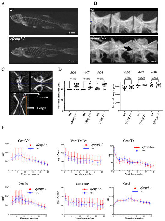 A Zebrafish Mutant in the Extracellular Matrix Protein Gene efemp1 as a ...