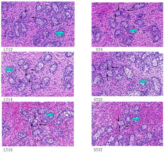Identification and Analysis of Genes Related to Testicular Size in 14 ...