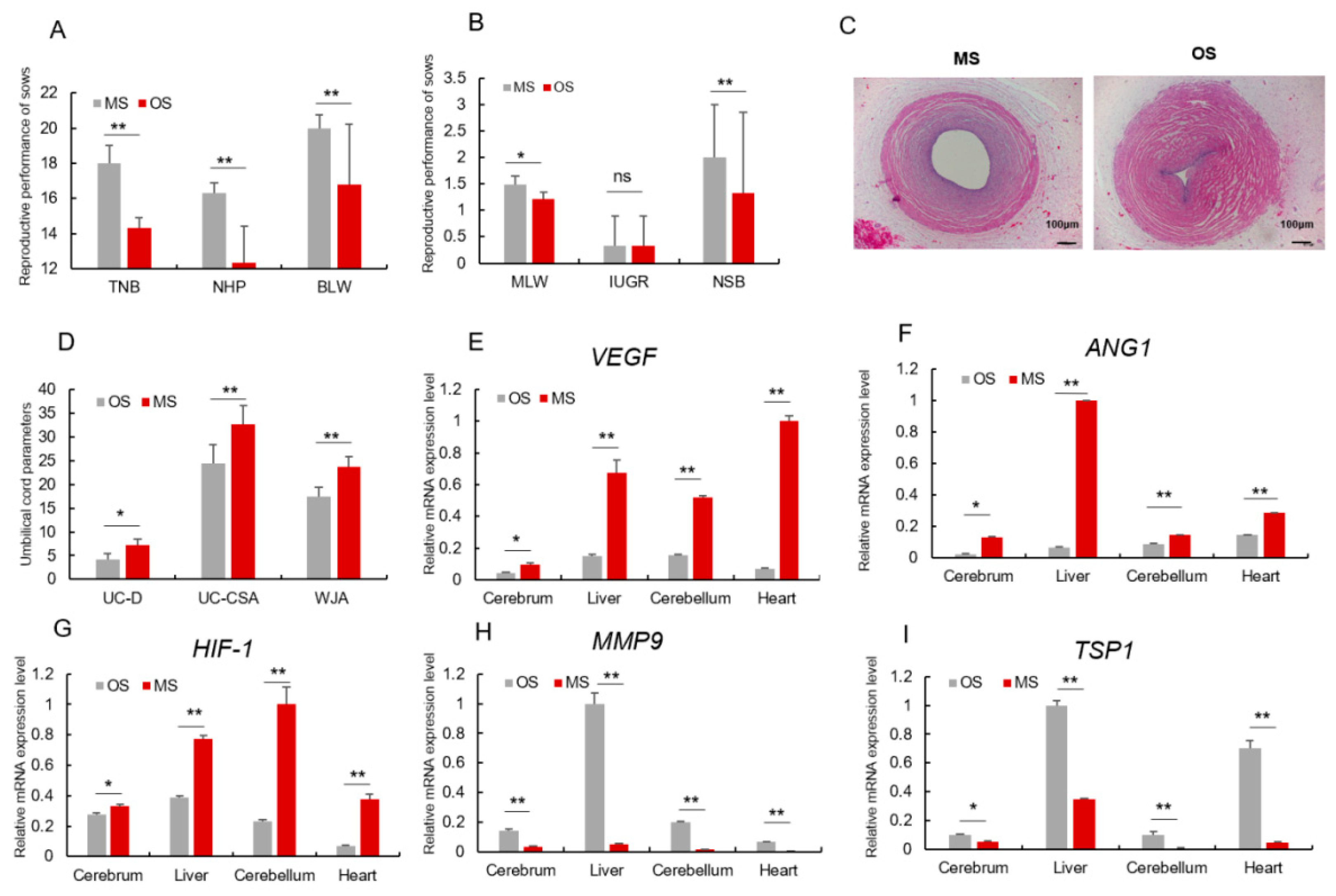 Correction: Pu et al. Exosome miRNA Expression in Umbilical Cord Blood ...