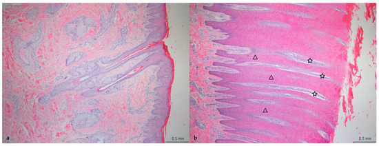 Local and Systemic Inflammation in Finnish Dairy Cows with Digital ...