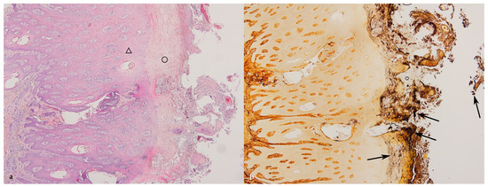 Local and Systemic Inflammation in Finnish Dairy Cows with Digital ...