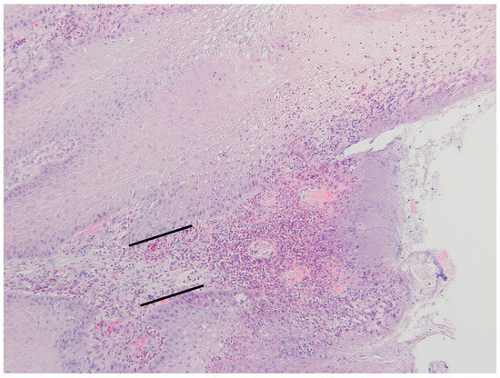 Local and Systemic Inflammation in Finnish Dairy Cows with Digital ...
