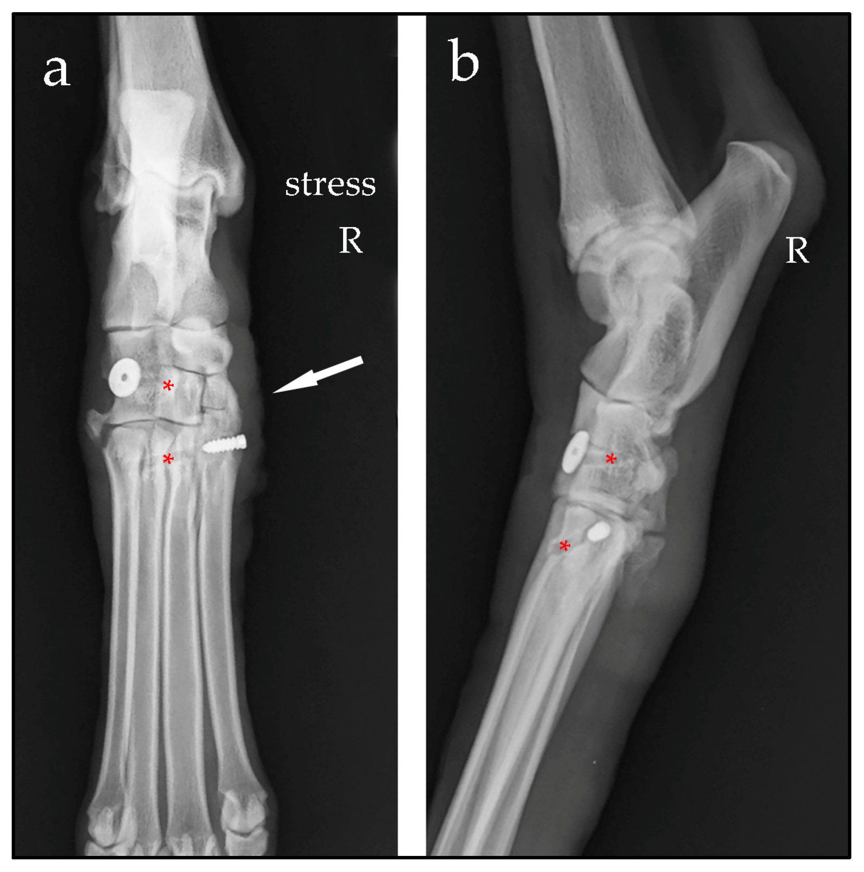 Treatment of Medial Instability of the Carpometacarpal and Tarsometatarsal Joints Using the ...