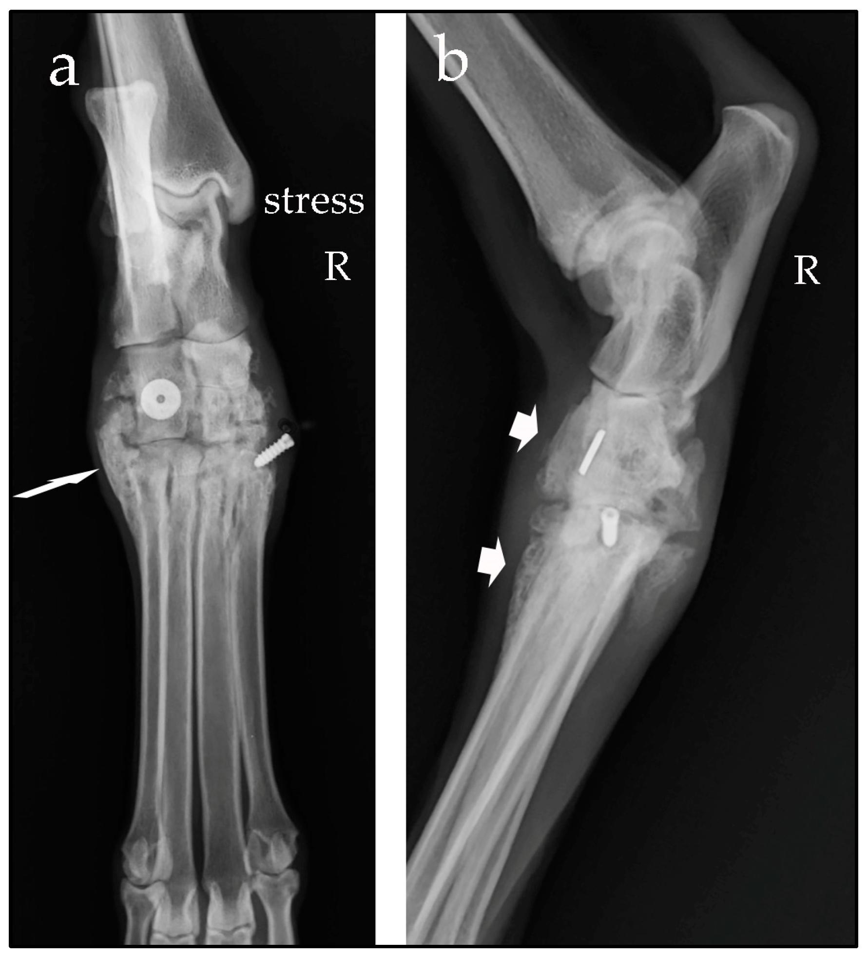 Treatment of Medial Instability of the Carpometacarpal and ...