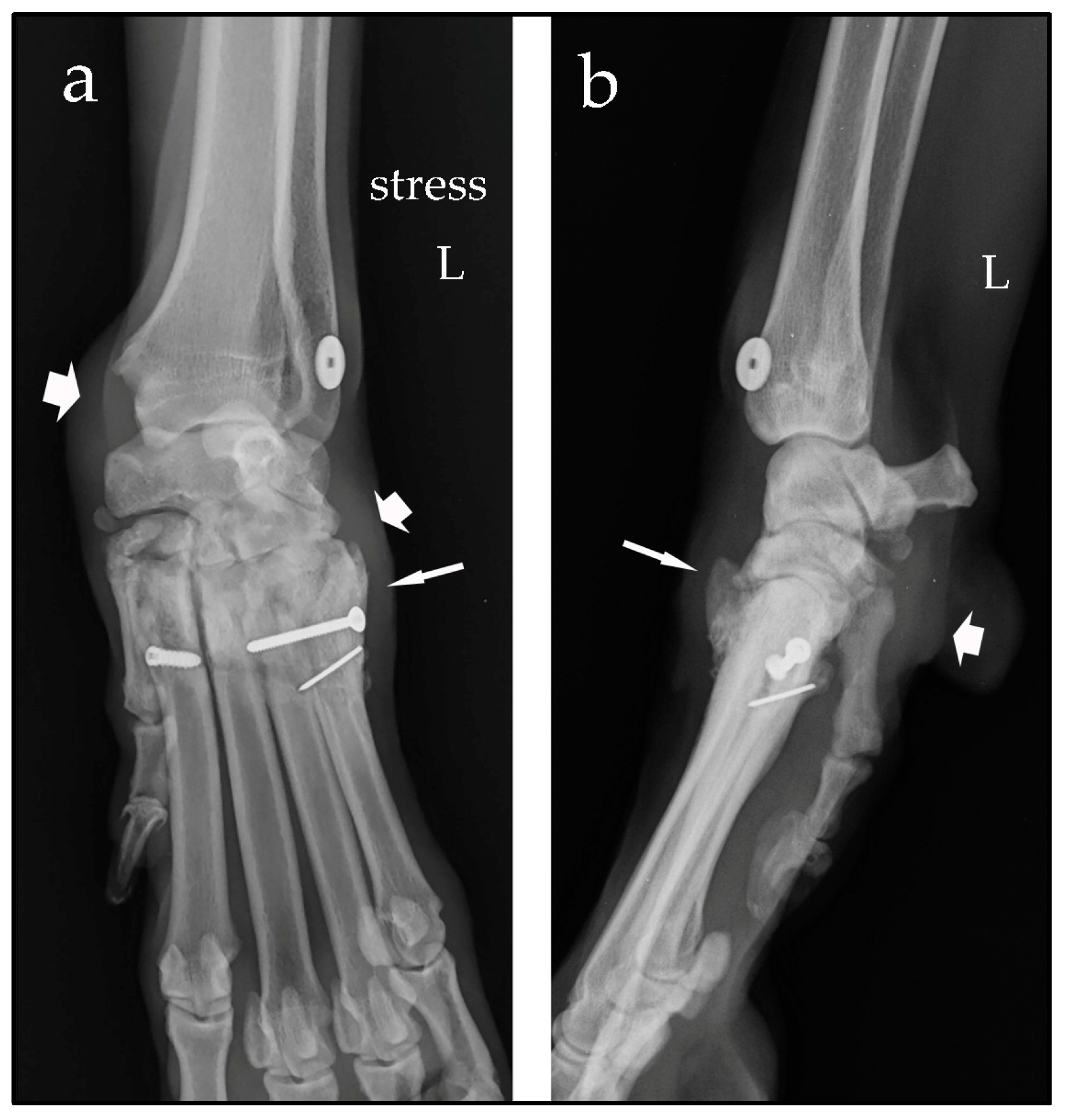 Treatment of Medial Instability of the Carpometacarpal and ...