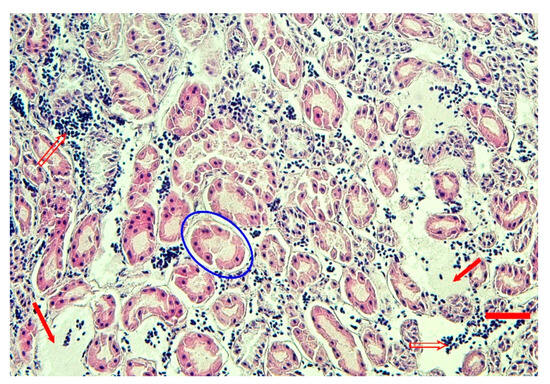 Poisoning by Nerium oleander L. in Franconia Geese