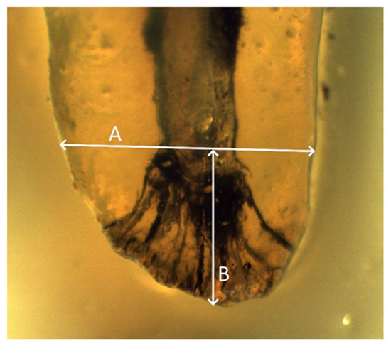 Comparative Morphology of the Carnassial Teeth Root Canals in Mixed ...