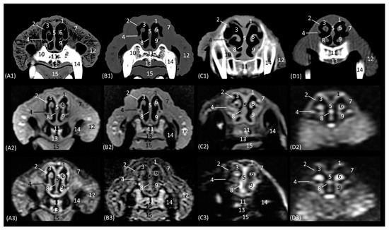 An Anatomical Study Using Computed Tomography, Magnetic Resonance ...