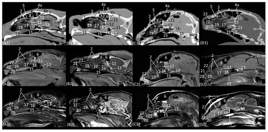 An Anatomical Study Using Computed Tomography, Magnetic Resonance ...