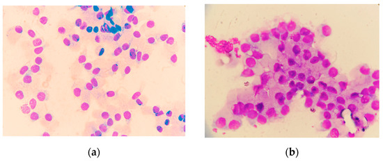 Comparative Evaluation of Diagnostic Methods for Subclinical Benign ...
