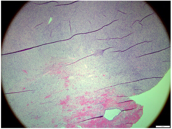 Animals | Free Full-Text | Ovarian Fibrothecoma in a Mare—Case Report