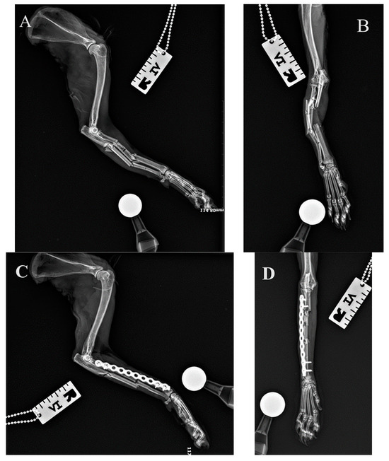 Minimally Invasive Plate Osteosynthesis (MIPO) of Comminuted Radial ...