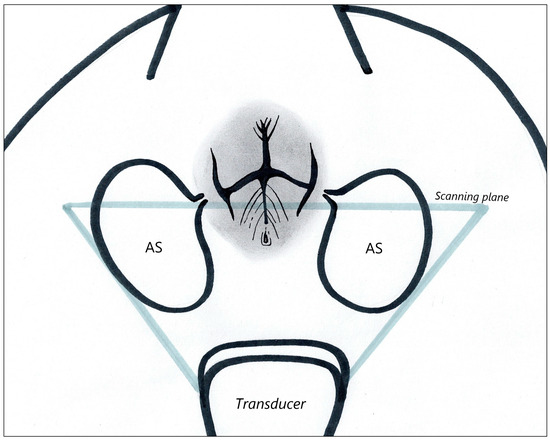 Ultrasound Morphology of Presumed Normal Anal Sacs in Dogs and Cats