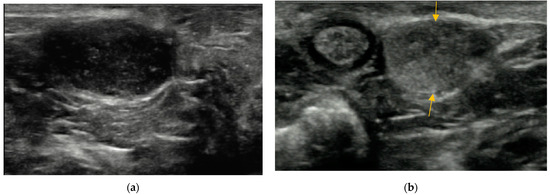 Ultrasound Morphology of Presumed Normal Anal Sacs in Dogs and Cats