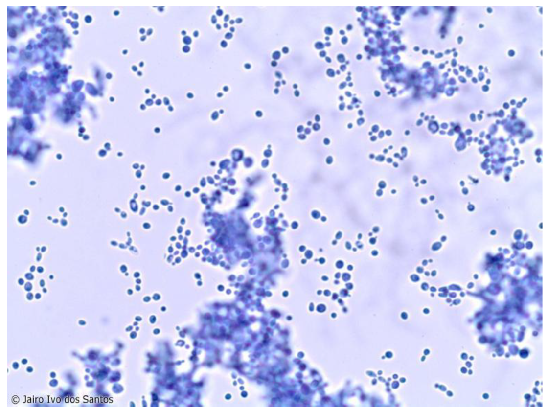 Candidiasis in Choloepus sp.—A Review of New Advances on the Disease