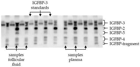 Association between IGF-1 and IGFBPs in Blood and Follicular Fluid in ...