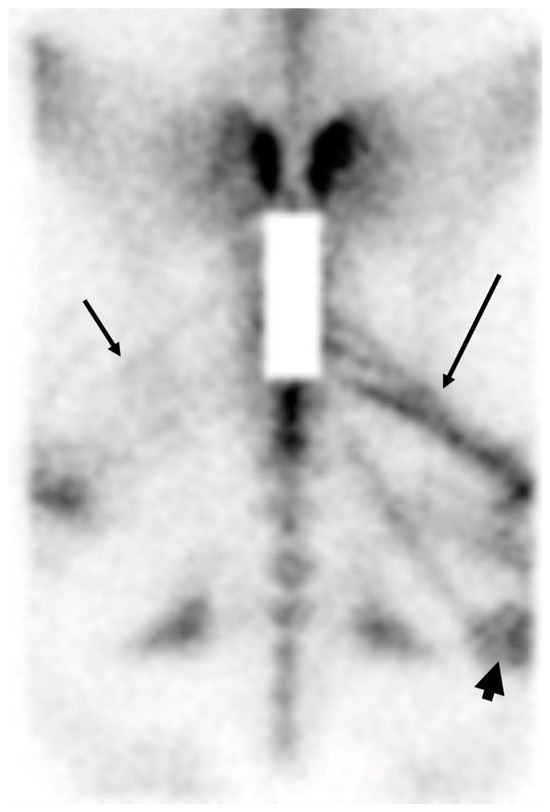 Equine Nuclear Medicine in 2024: Use and Value of Scintigraphy and PET ...