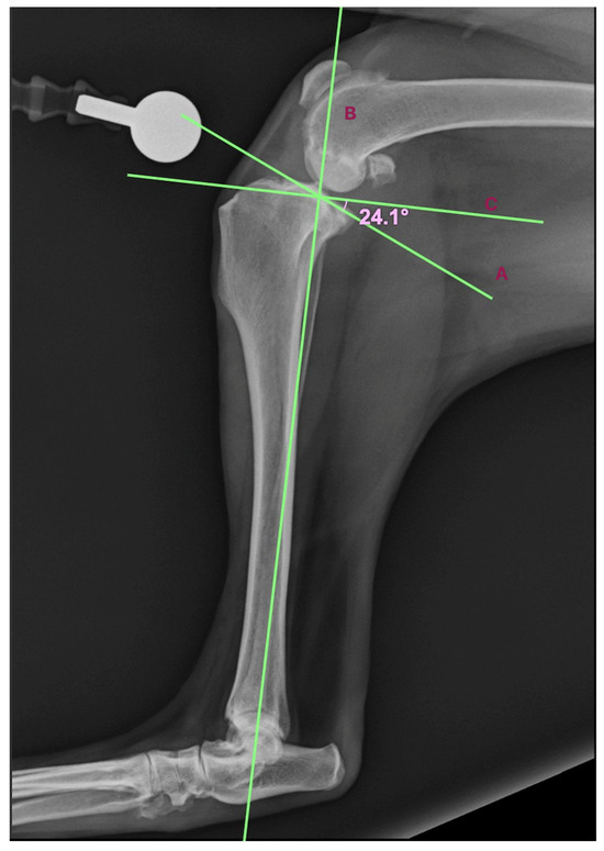 Long-Term Changes in Tibial Plateau Angle (TPA) Following Tibial ...