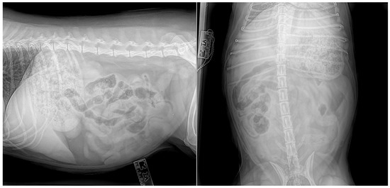 Intestinal Incarceration and Strangulation by the Median Ligament of ...