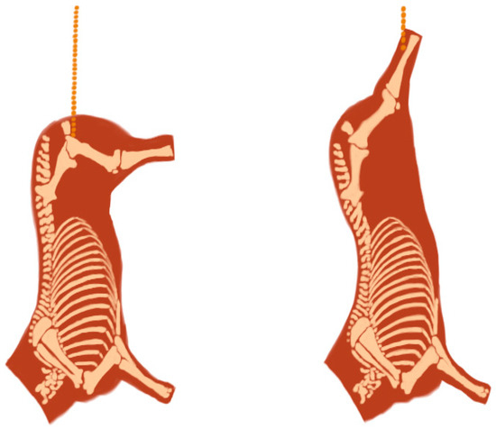 Can the Suspension Method (Tenderstretch vs. Achilles Tendon) Enhance ...