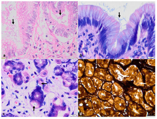 Pathological and Immunohistochemical Characterization of Follicular ...