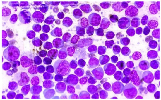 Canine Multicentric Lymphoma: Diagnostic, Treatment, and Prognostic ...