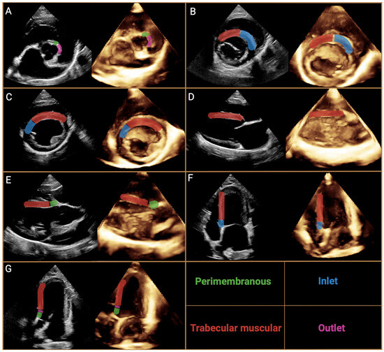A Comprehensive Review of Canine and Feline Ventricular Septal Defects ...