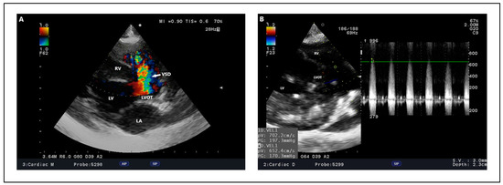 A Comprehensive Review of Canine and Feline Ventricular Septal Defects ...
