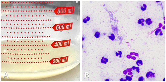 Successful Management of Recurrent Pyothorax in a Cat: Clinical ...