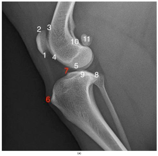 Comparative Radiographic Analysis of Trochleoplasties for Patellar ...